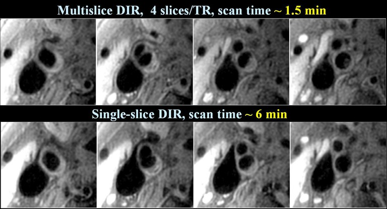 Imaging Physics | Department of Radiology