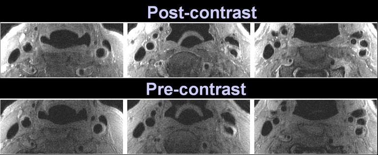 Imaging Physics | Department of Radiology